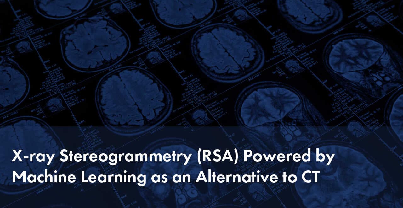 Röntgen-Stereogrammetrie (RSA) betrieben von Machine Learning als ...